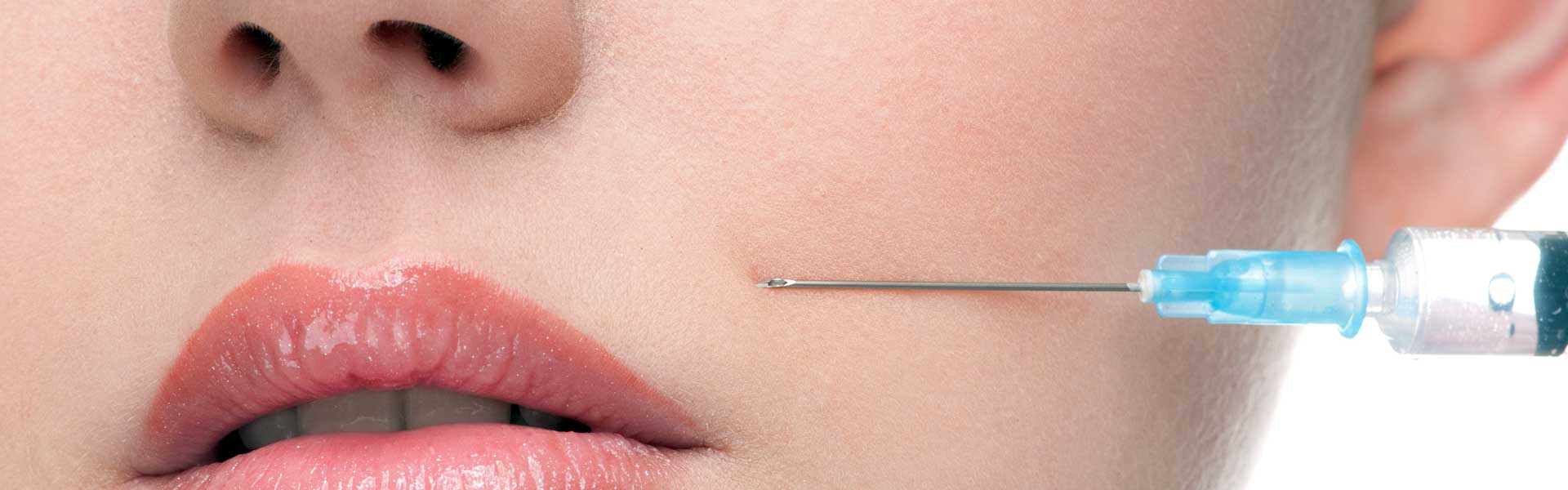 Les injections d'acide hyaluronique pour le sillon nasogénien à Paris ...